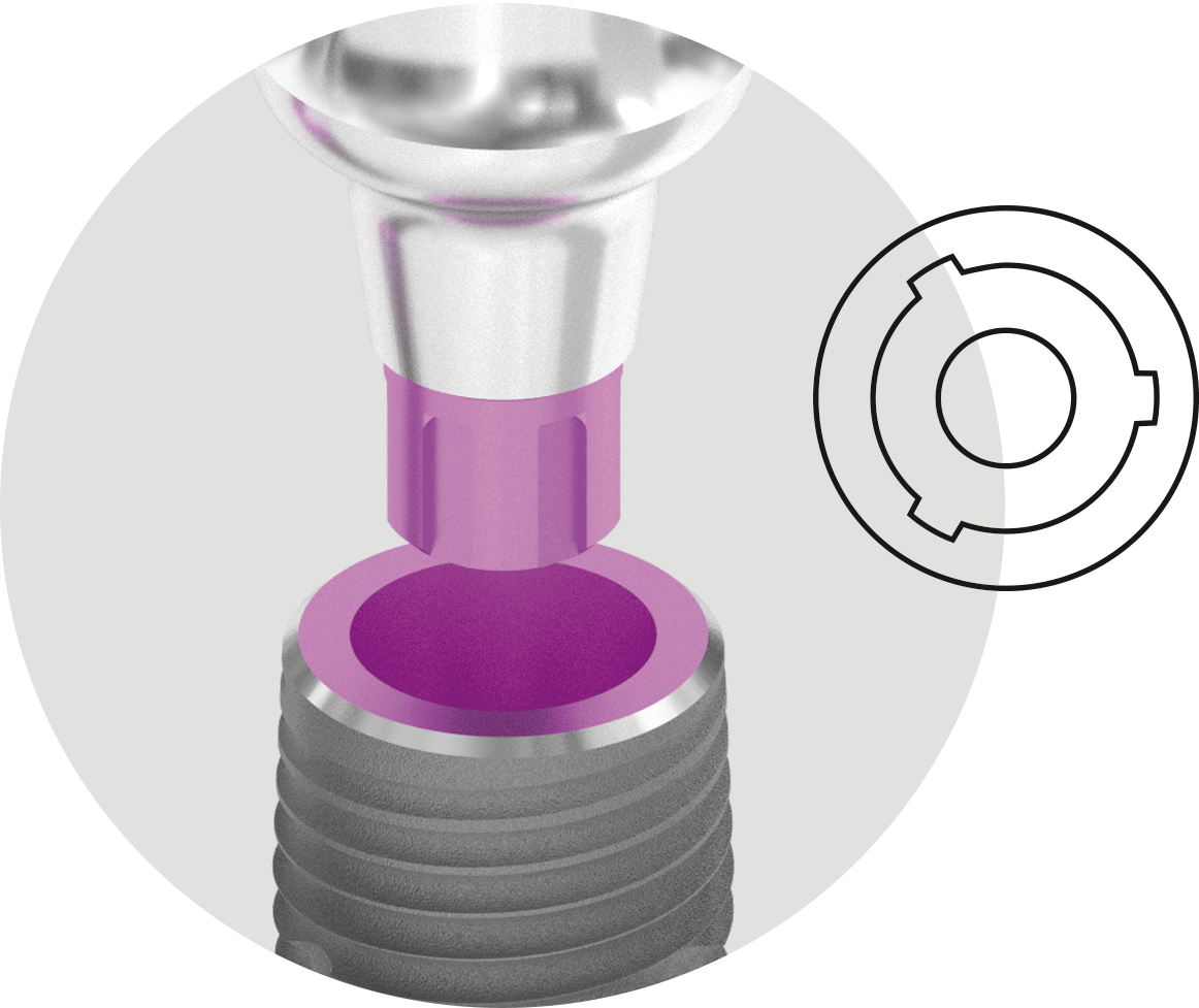 CortiCON Implant System | BIONIKA